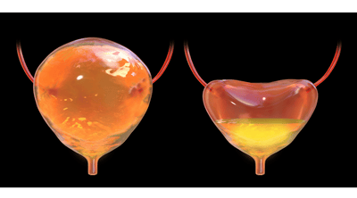 Understanding Your Bladder: A Vital Organ for Your Health